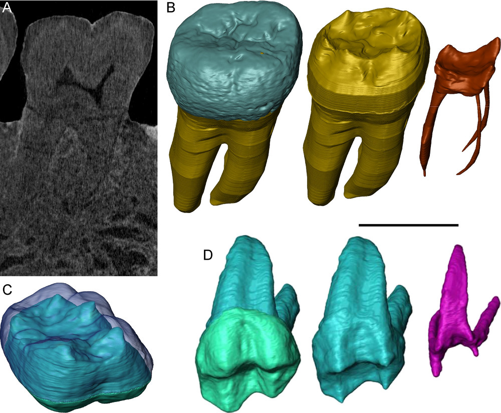 Deep look into teeth with neutrons / MLZ